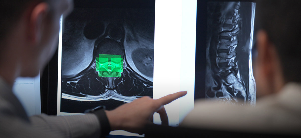 What AI May Tell You About Your Lower Back Pain NUHS what-ai-may-tell-you-about-your-lower-back-pain-nuhs